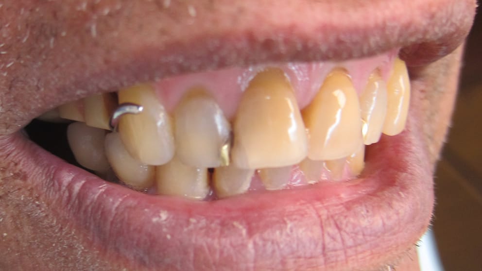 New York Family Dentistry | Brooklyn