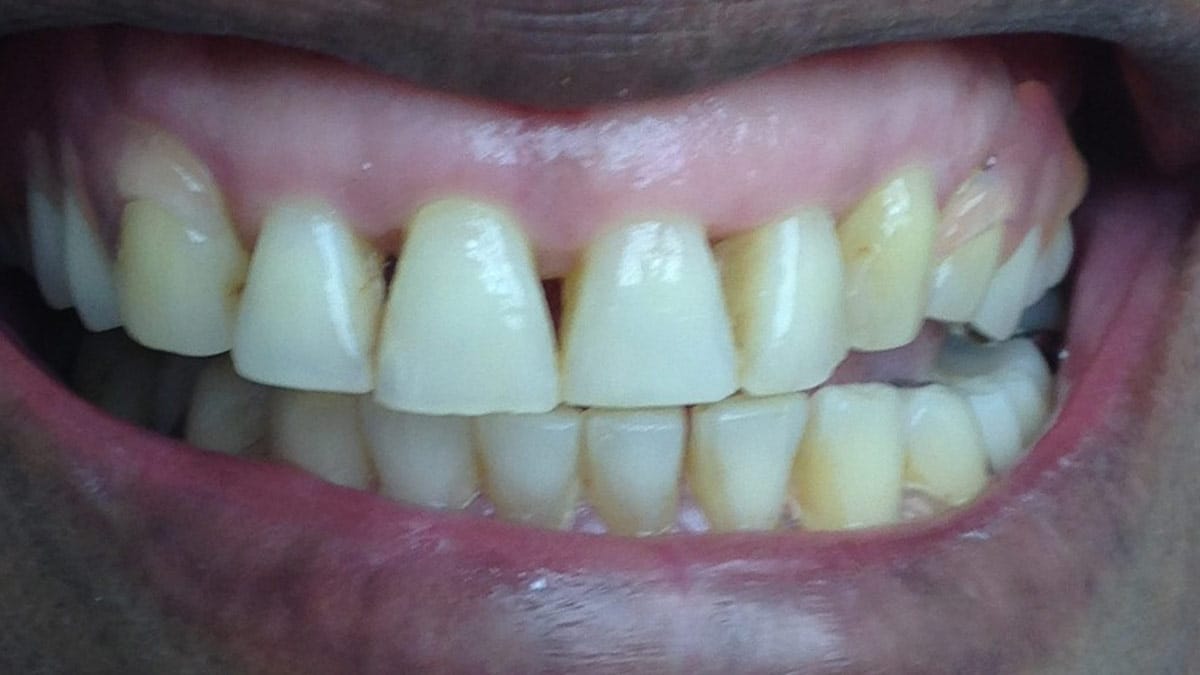 New York Family Dentistry | Brooklyn