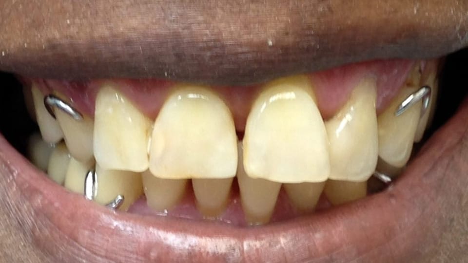 New York Family Dentistry | Brooklyn