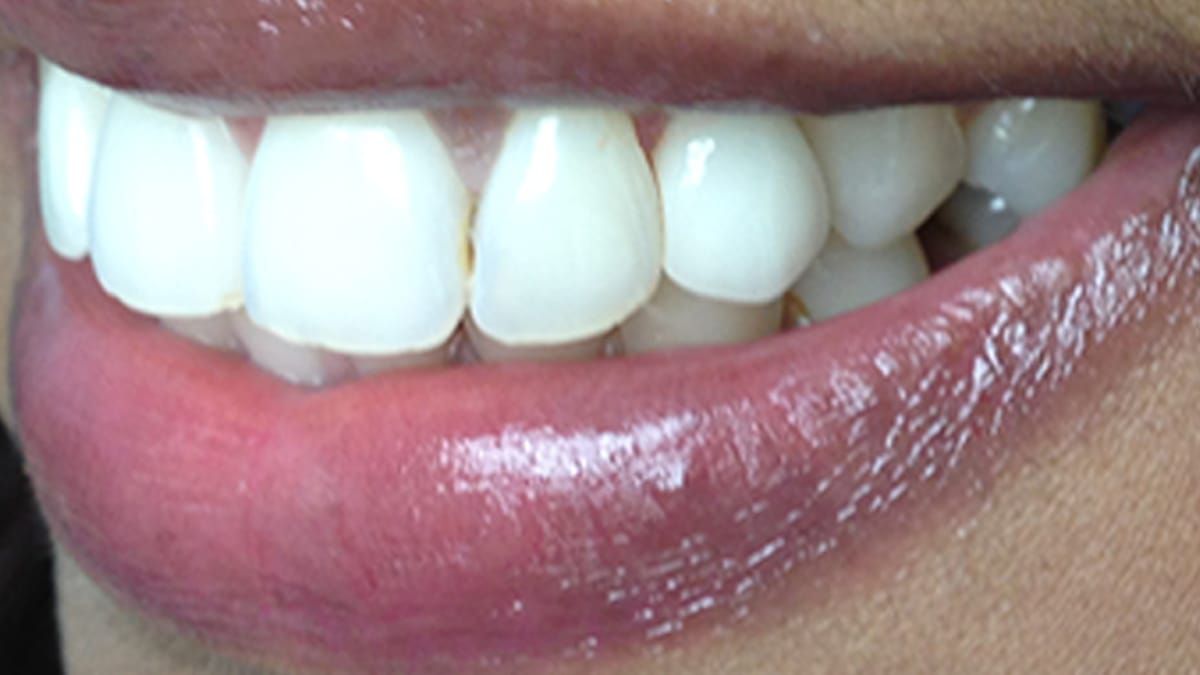 New York Family Dentistry | Brooklyn