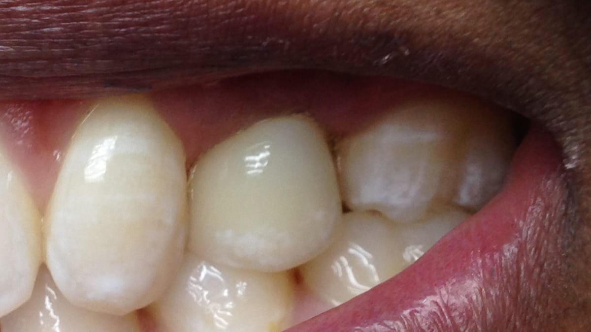 New York Family Dentistry | Brooklyn